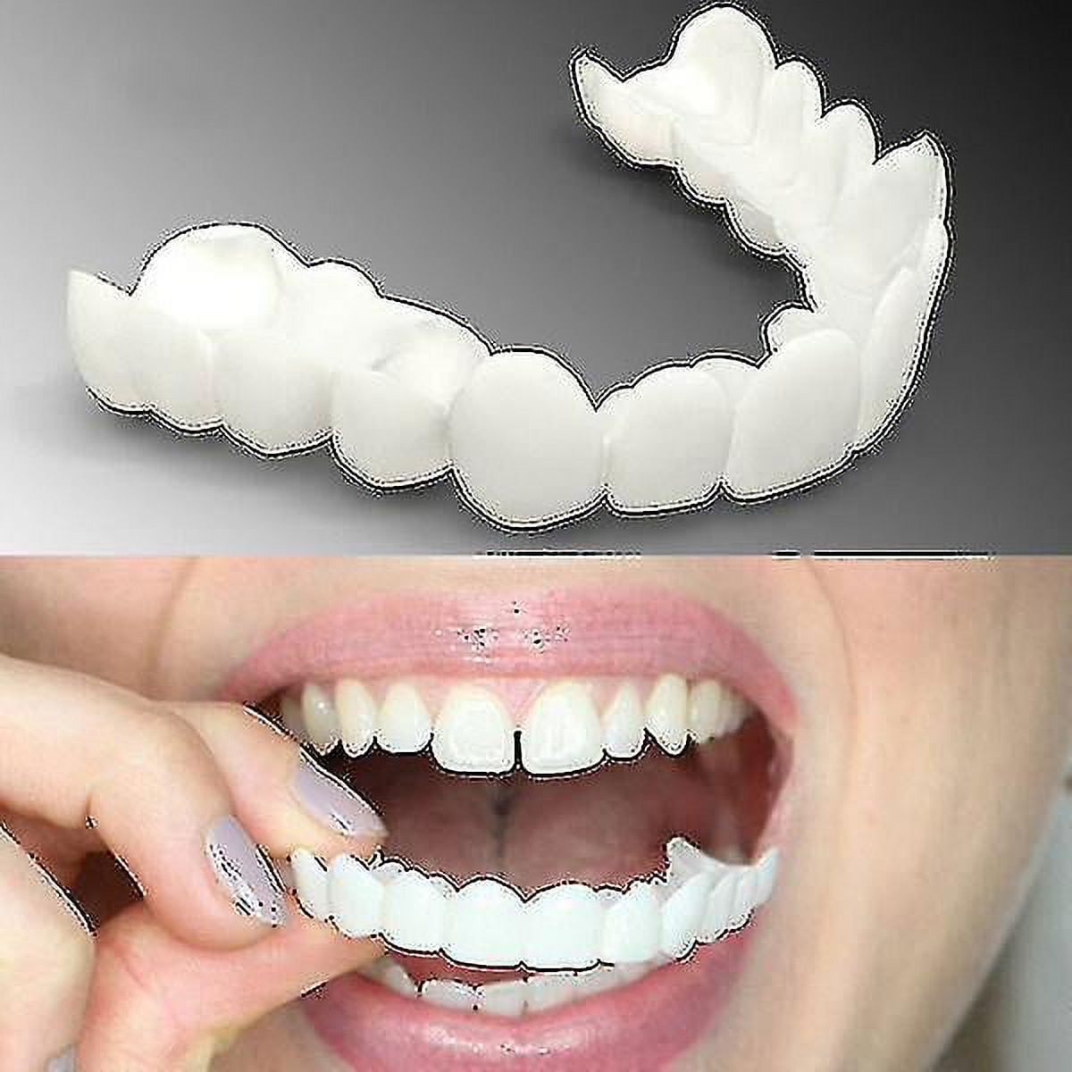 Click here for Jiachy Upper/Lower Comfort Fit Flex Whitening Dent... prices