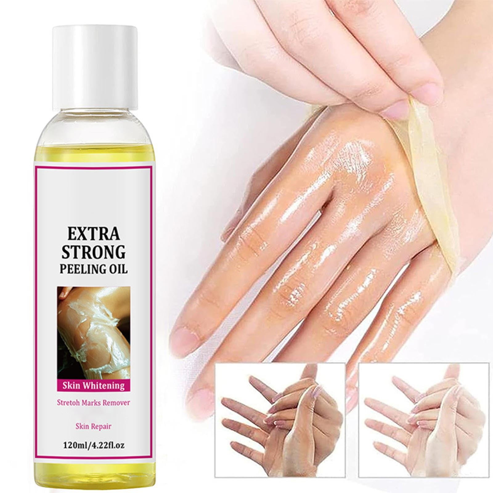 Acete Exfoliante onlyliua 120 Ml Loción Corporal Hidratante Eliminadora ...