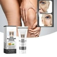 Skin discoloration REMEDY Dermatologist-recommended Freckle Treatment ... Skin discoloration REMEDY Dermatologist-recommended Freckle Treatment ...