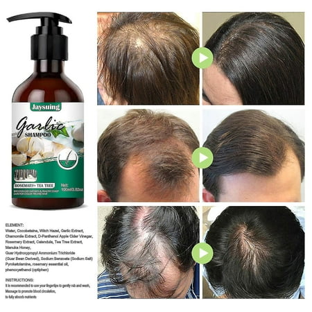 Garlic Shampoo Deep Cleansing Effective Hair Loss Treatment_(costbuy ...