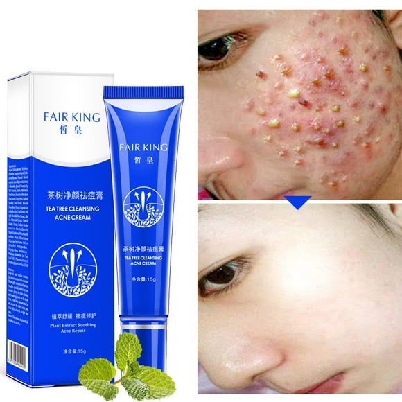 Acne Creams in Acne Treatments - Walmart.com