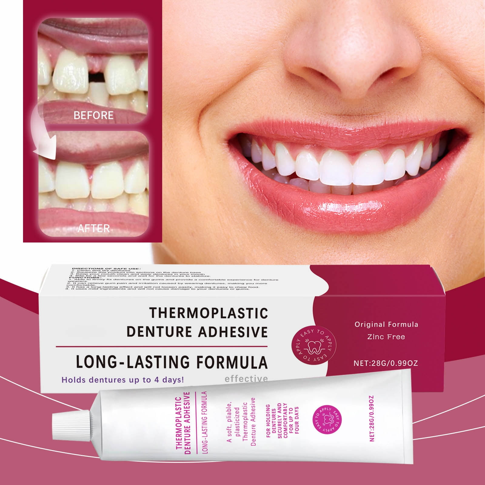 Bagmrteho Denture Fixing Fix Dentures To Improve Comfort And Beautify ...