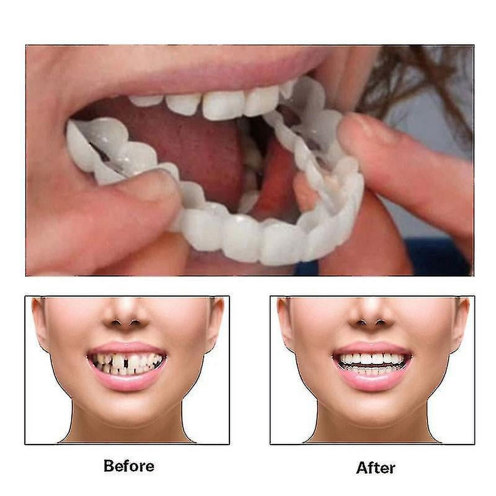 Click here for Vorcoy Snap On Smile Silicone Artificial Teeth Den... prices