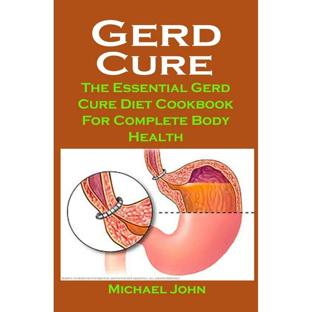 Gerd Cure : Gerd Cure: The Essential Gerd Cure Diet Cookbook For ...
