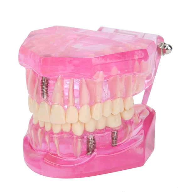 Adult Teeth Model,Transparent Adult Teeth Model Denture Model Dental ...