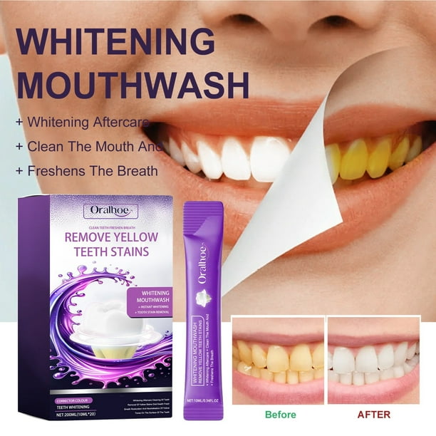 Clean Purple Teeth Whitening Mouthwash Teeth Cleaning Yellow Teeth ...