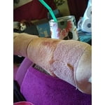 Telfa Ouchless Sterile Non-Adherent Wound Care Pads, Gauze Dressings ...