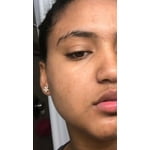 Perrigo Body Wash with 5% Benzoyl Peroxide, 142g Liquid - Walmart.com