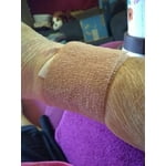 Telfa Ouchless Sterile Non-Adherent Wound Care Pads, Gauze Dressings ...