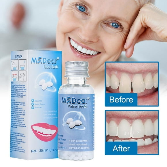 Temporary Tooth Filling