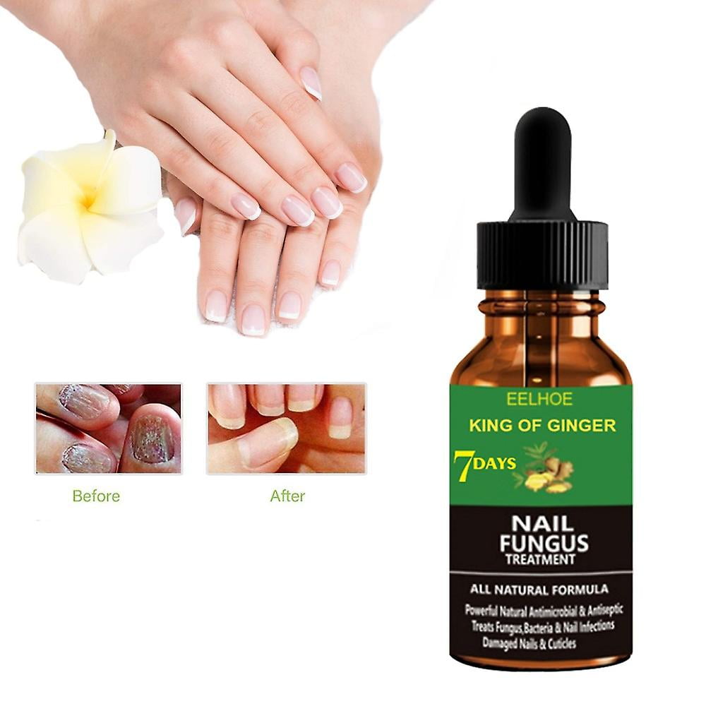1-3pcs 7 Days Nails Care Repair Nail Fungal Anti-fungus Onychomycosis ...