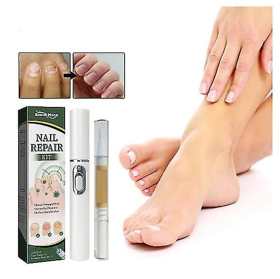 1/3pcs Anti Fungal Treatment Anti Fungus Onychomycosis Paronychia ...