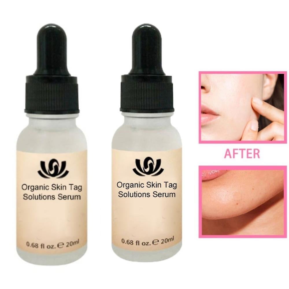 1-4PCS Wart Remover Pen Skin Tag Mole Remover Eliminate Foot Corn Warts ...