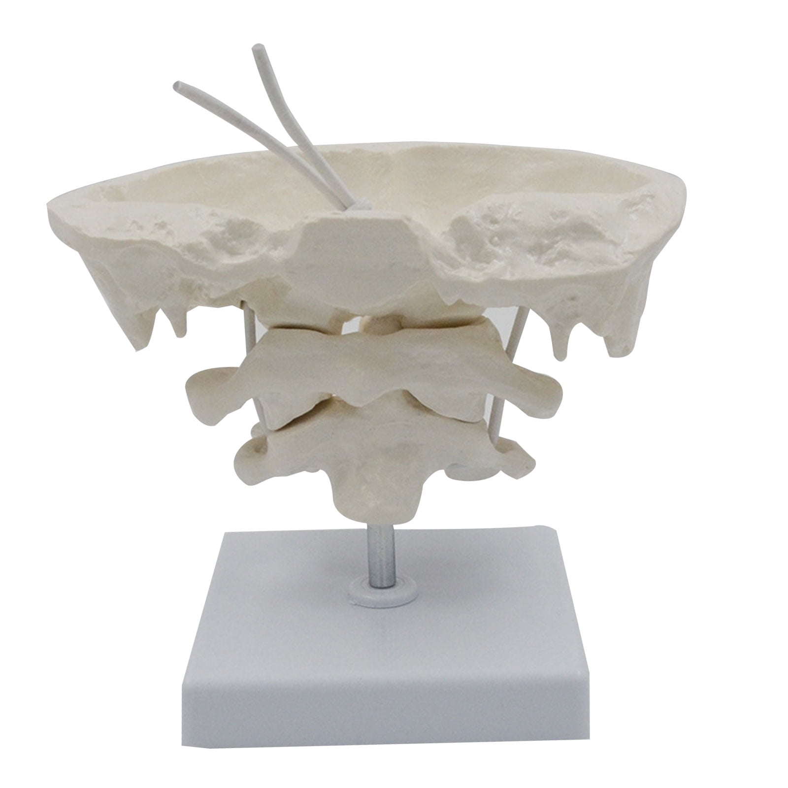 1.5x Magnification Human Cervical Model Occipital Bone Model Teaching ...