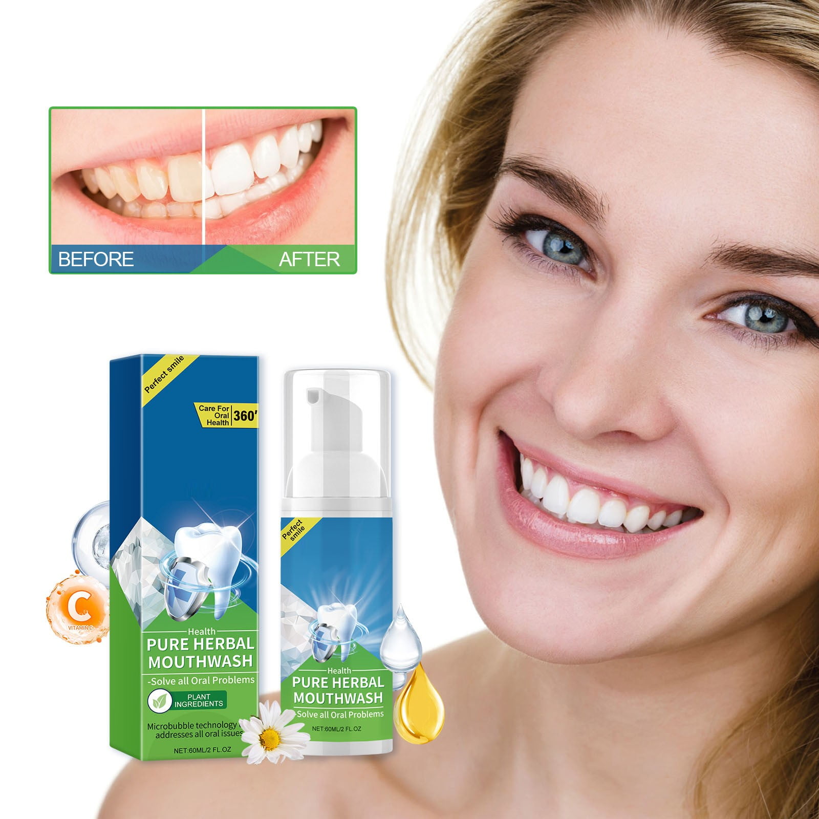 1*Oral Mousse Vikudy Reduce Price! Enhance Oral Health Freshen Breath ...