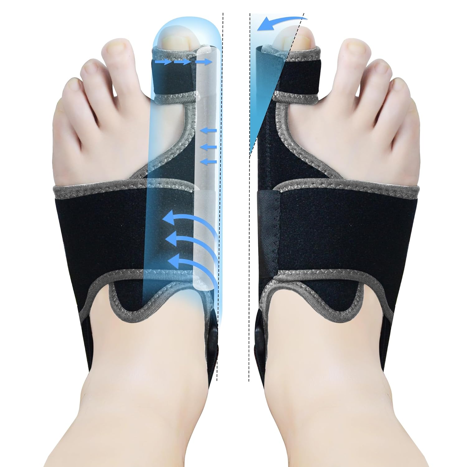 1 Pair Foot Bunion Corrector for Women & Men, Night Bunion Splint, Big ...
