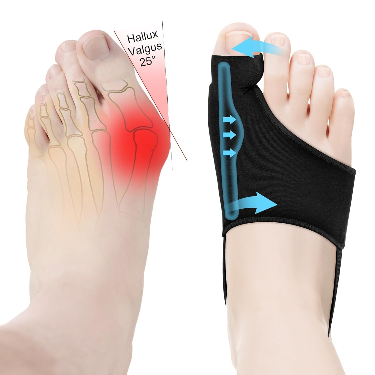 1 Pair Upgraded Bunion Corrector for Women & Men, Comfortable ...