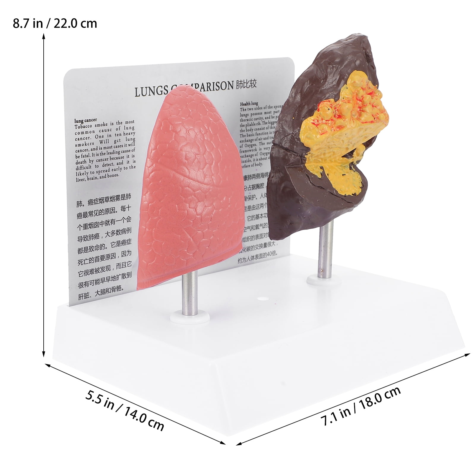 1 Pc Lung Comparison Model for Smoking and Normal Lungs - Walmart.com