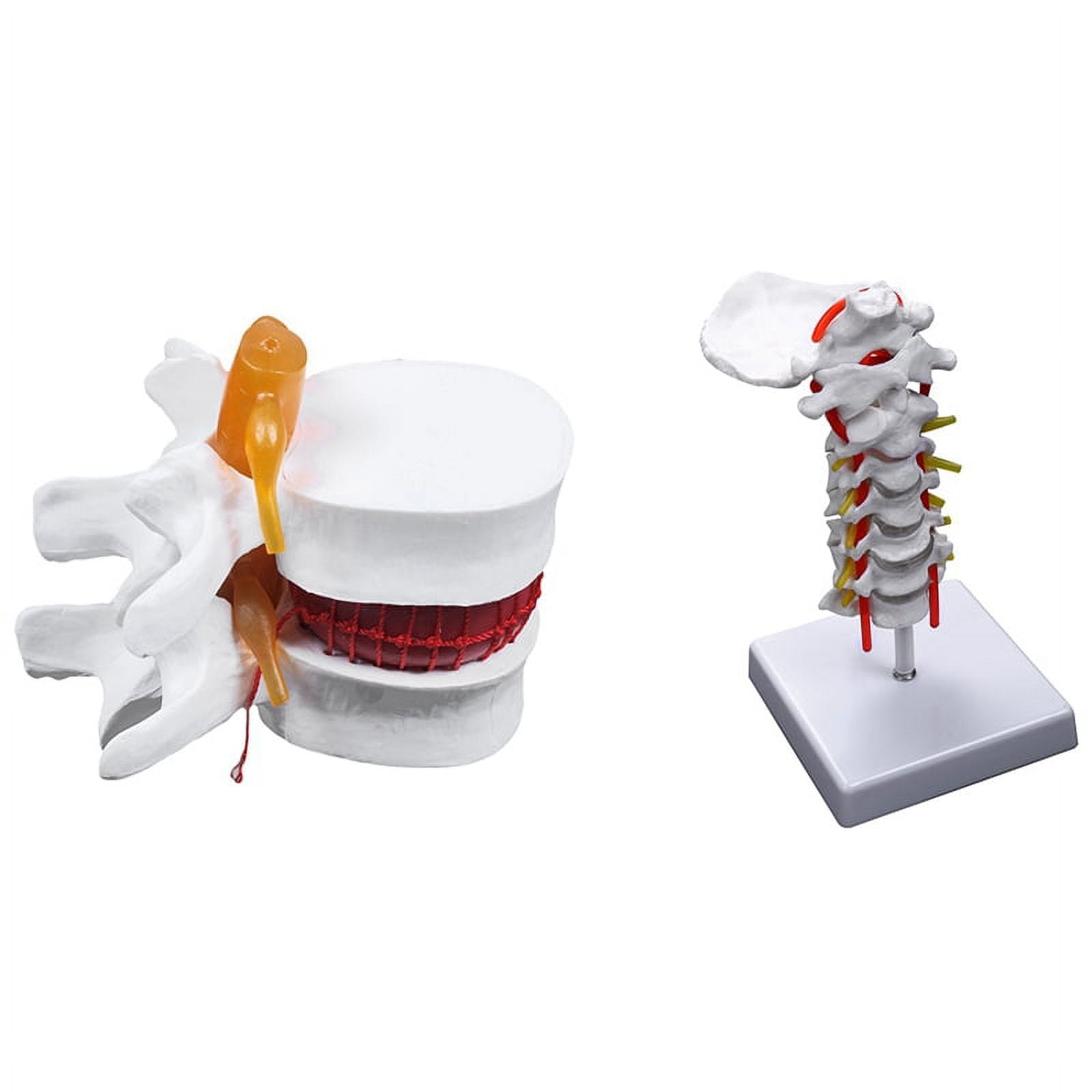 1 Pcs Human Anatomy Skeleton Spine Lumbar Disc Teaching Model & 1 Pcs ...