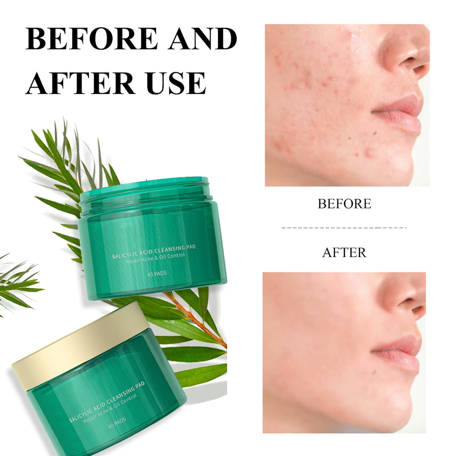 1 Salicylic Acid Cotton Pad Vikudy Reduce Price! Glycolic Pads 30% ... 1 Salicylic Acid Cotton Pad Vikudy Reduce Price! Glycolic Pads 30% ...