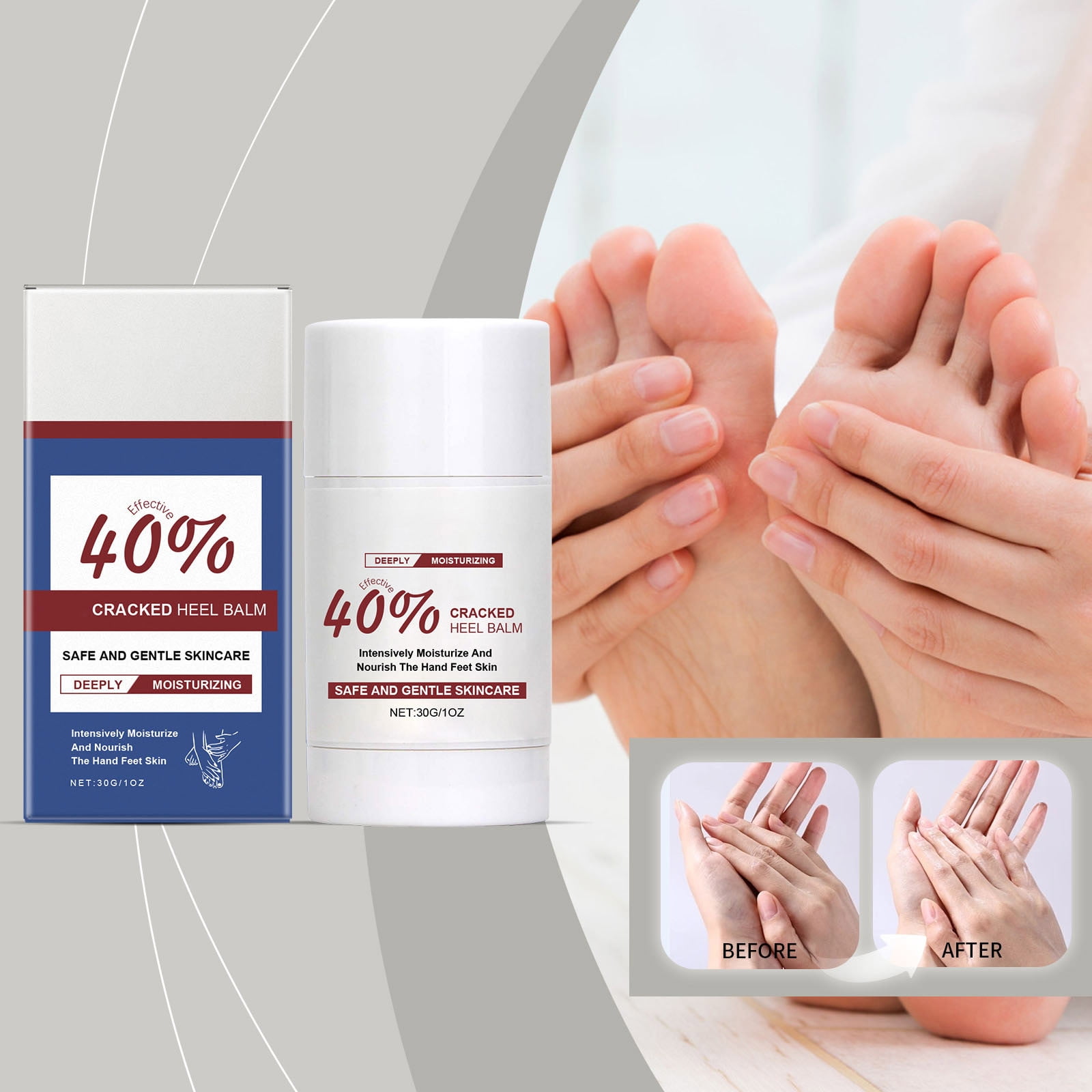 Under 10, Moisturizing Cracking Foot Urea Cream, Foot Cream s Cracks ...