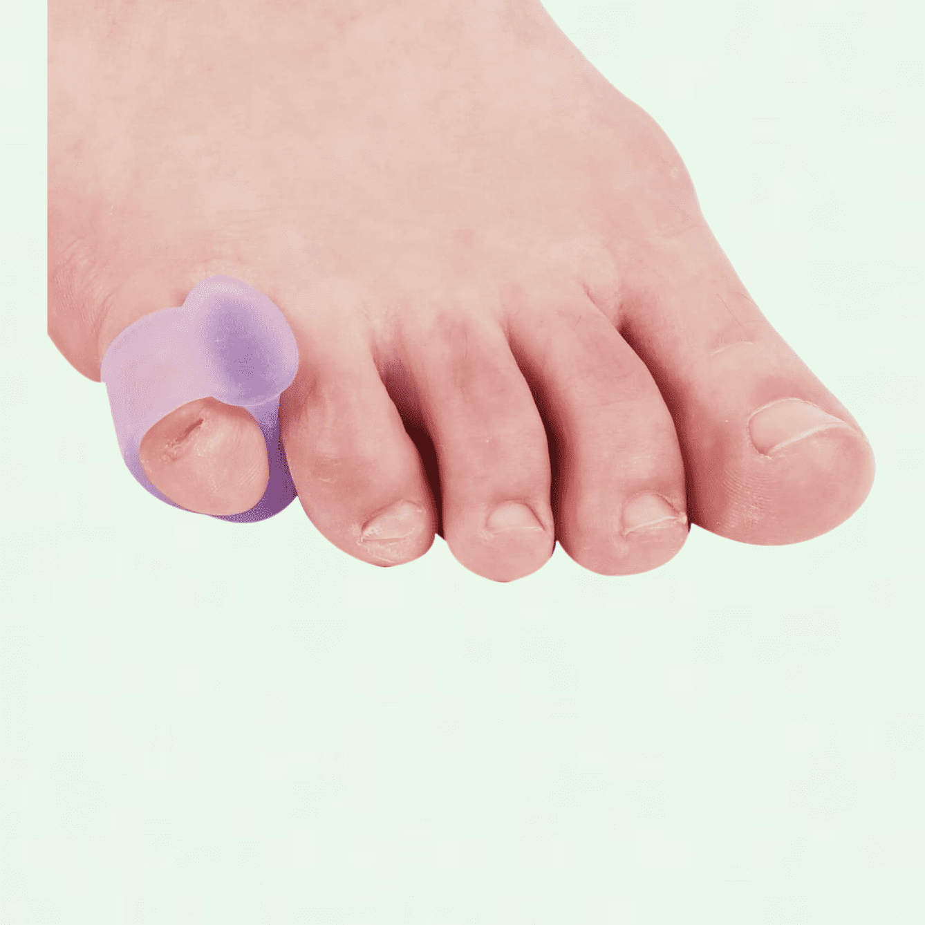 Pinky Toe Splint Set of 10, Gel Toe Separators for Overlapping Toes ...