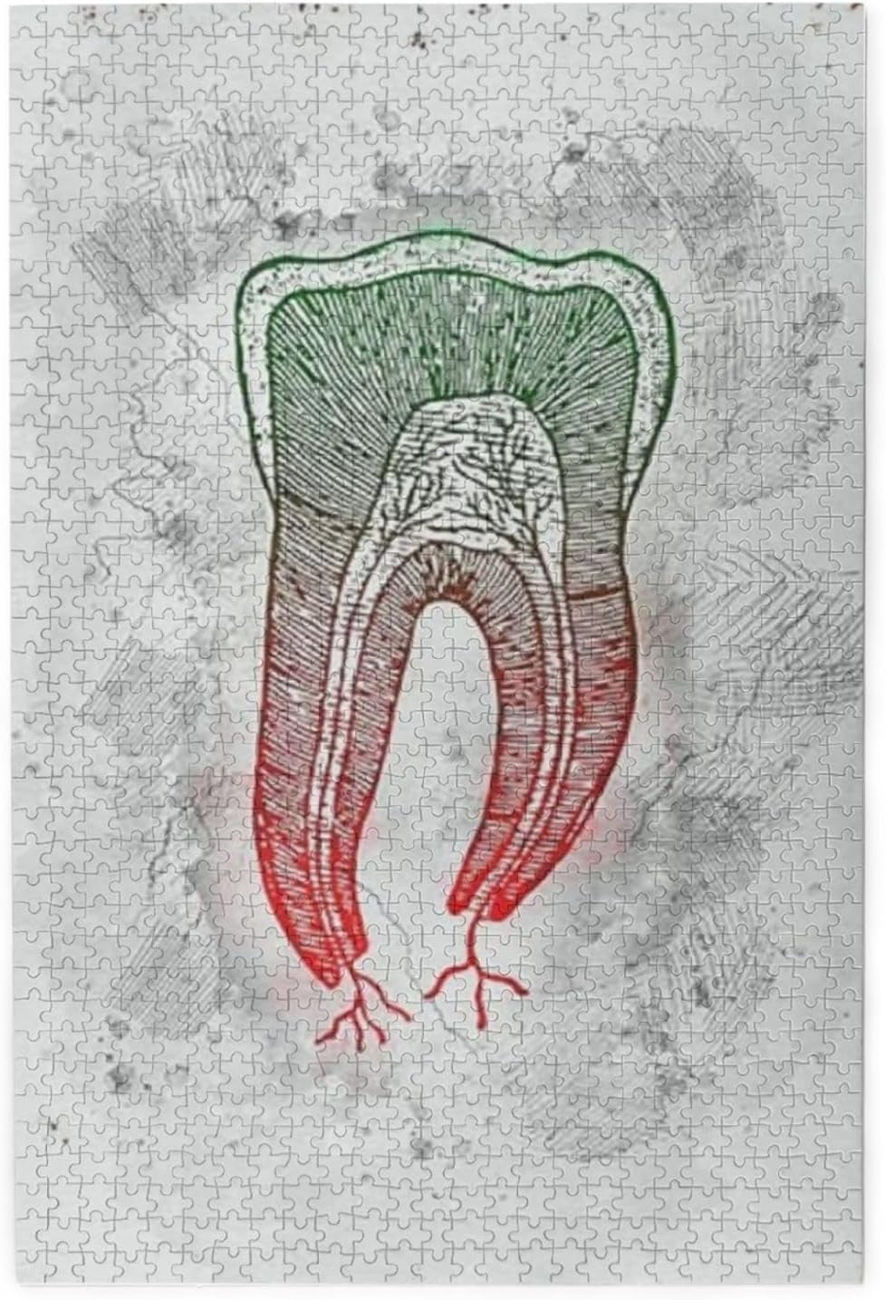 1000 Piece Jigsaw Puzzles Dentist Office Decor Tooth Cross Section ...