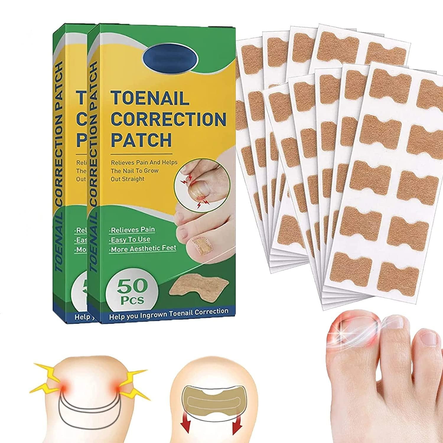 100Pcs Ingrown Toenail Corrector Sticker Foot Care Paronychia Treatment ...