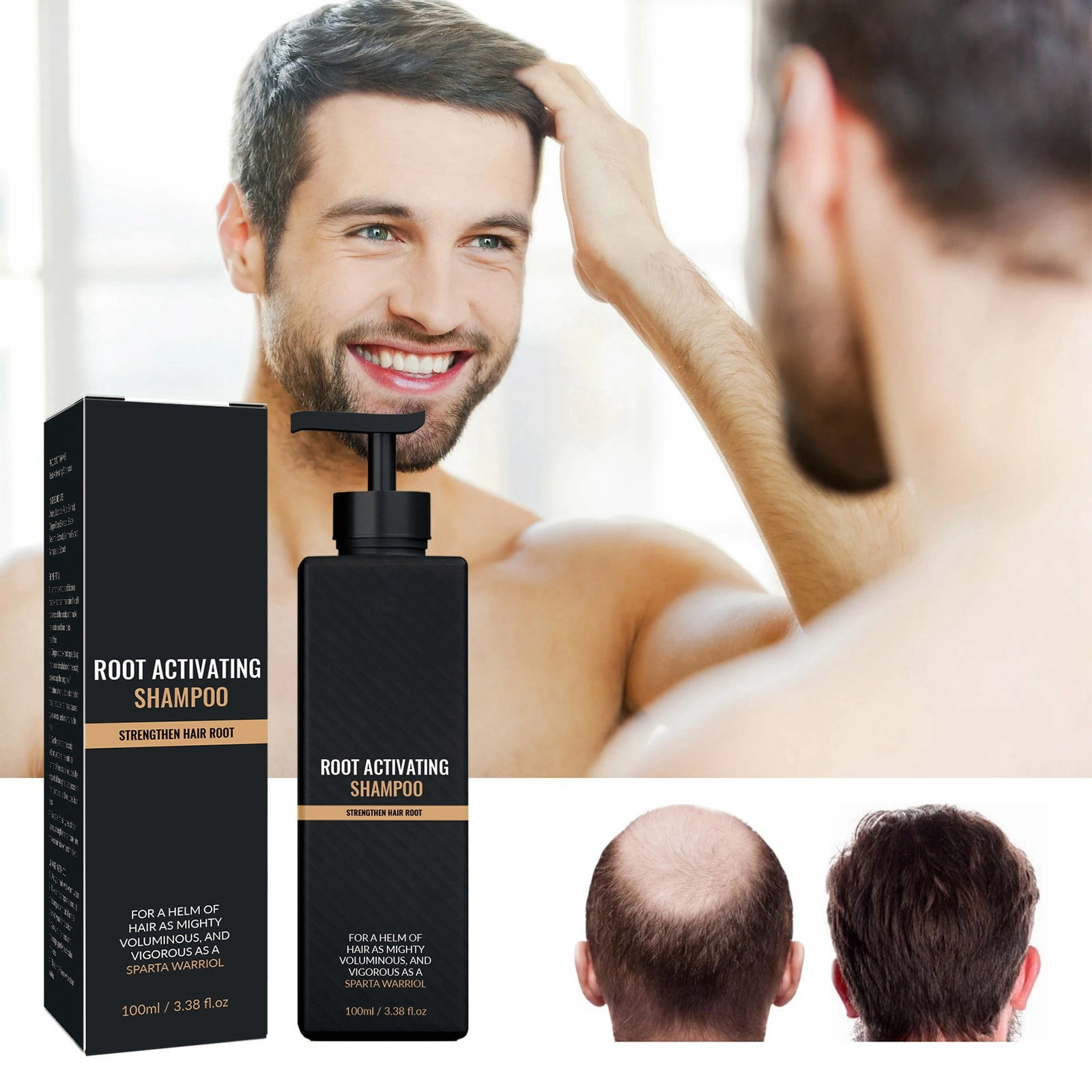 100ml Root Shampoo for Men Women,Thick And Smooth Hair, Natural Hair ...