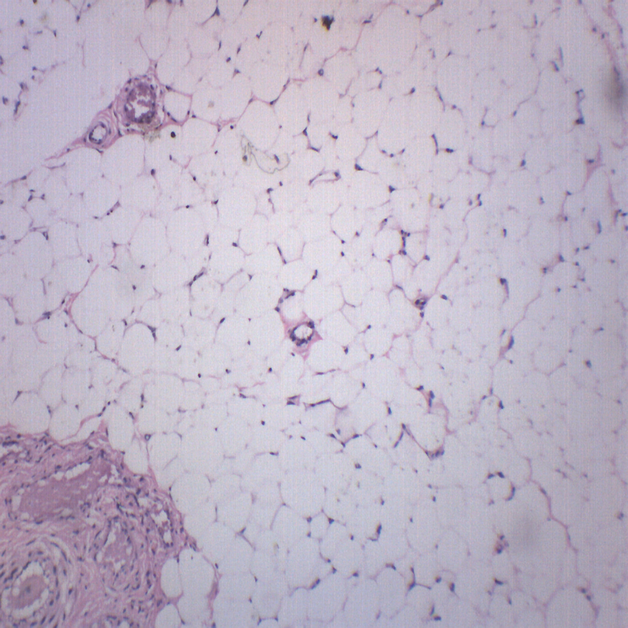 10PK Adipose Tissue Section, Human, Prepared Microscope Slides ...