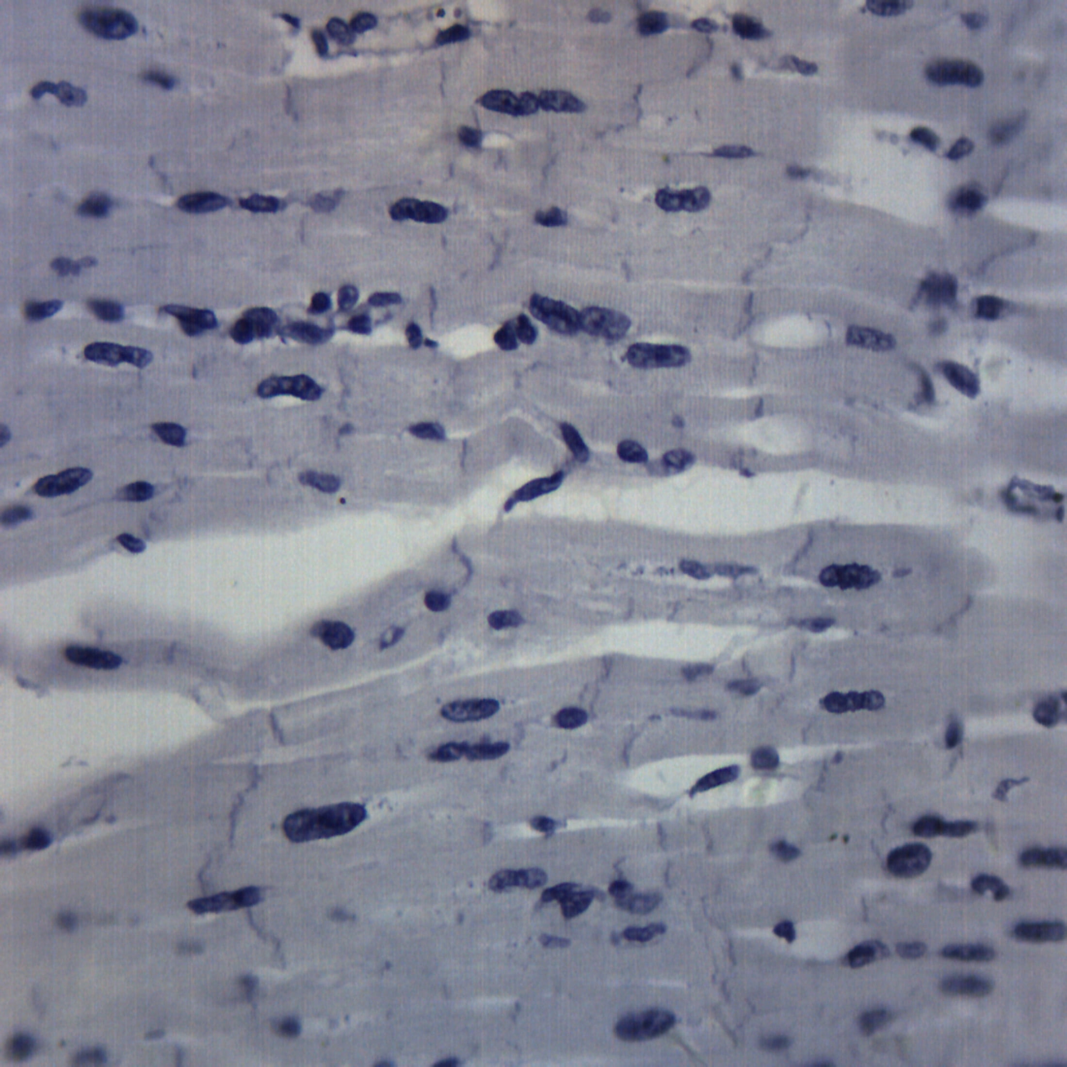 10PK Cardiac Muscle, Longitudinal Section - Prepared Microscope Slides ...