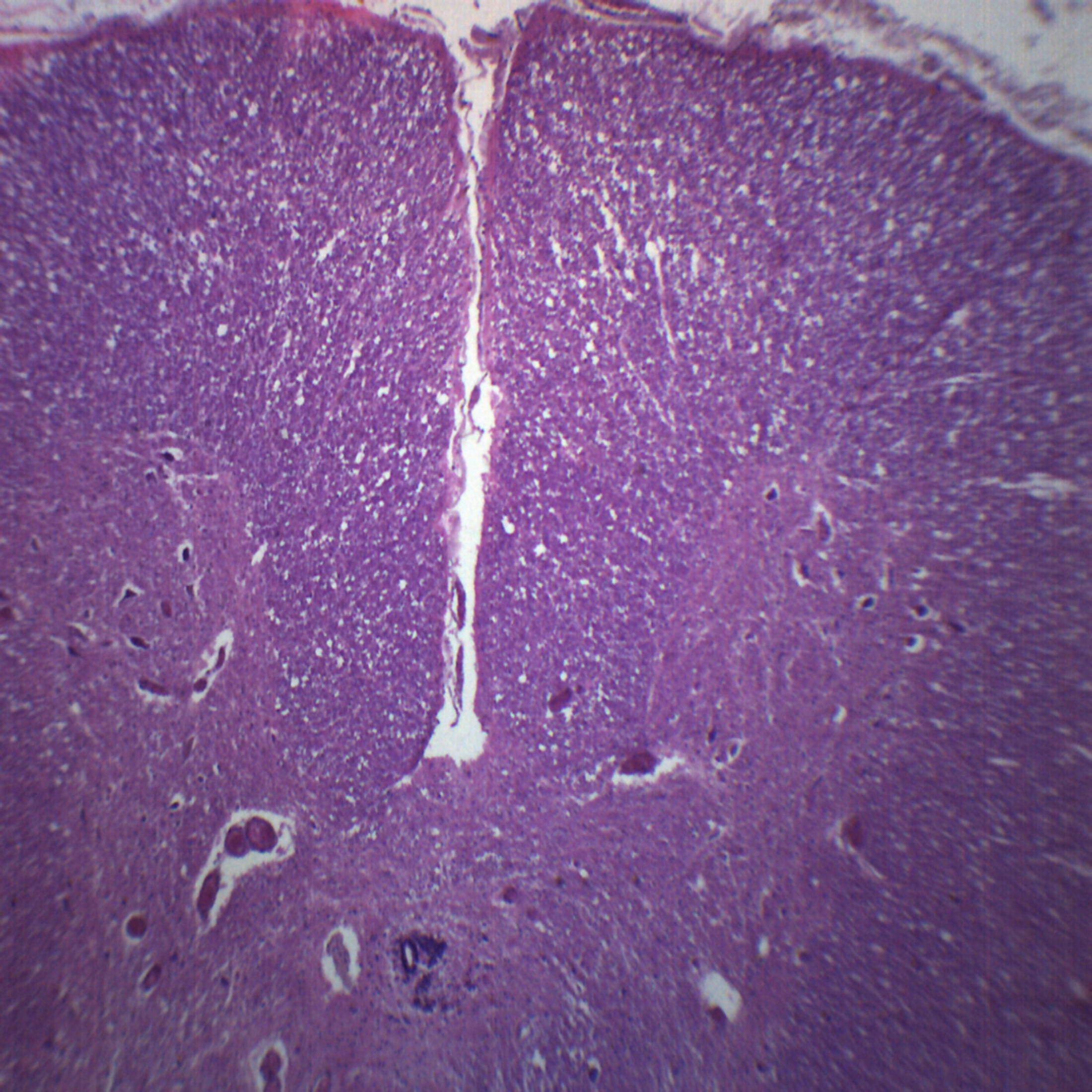 10PK Cervical Spinal Cord, Human - Cross Section - Prepared Microscope ...