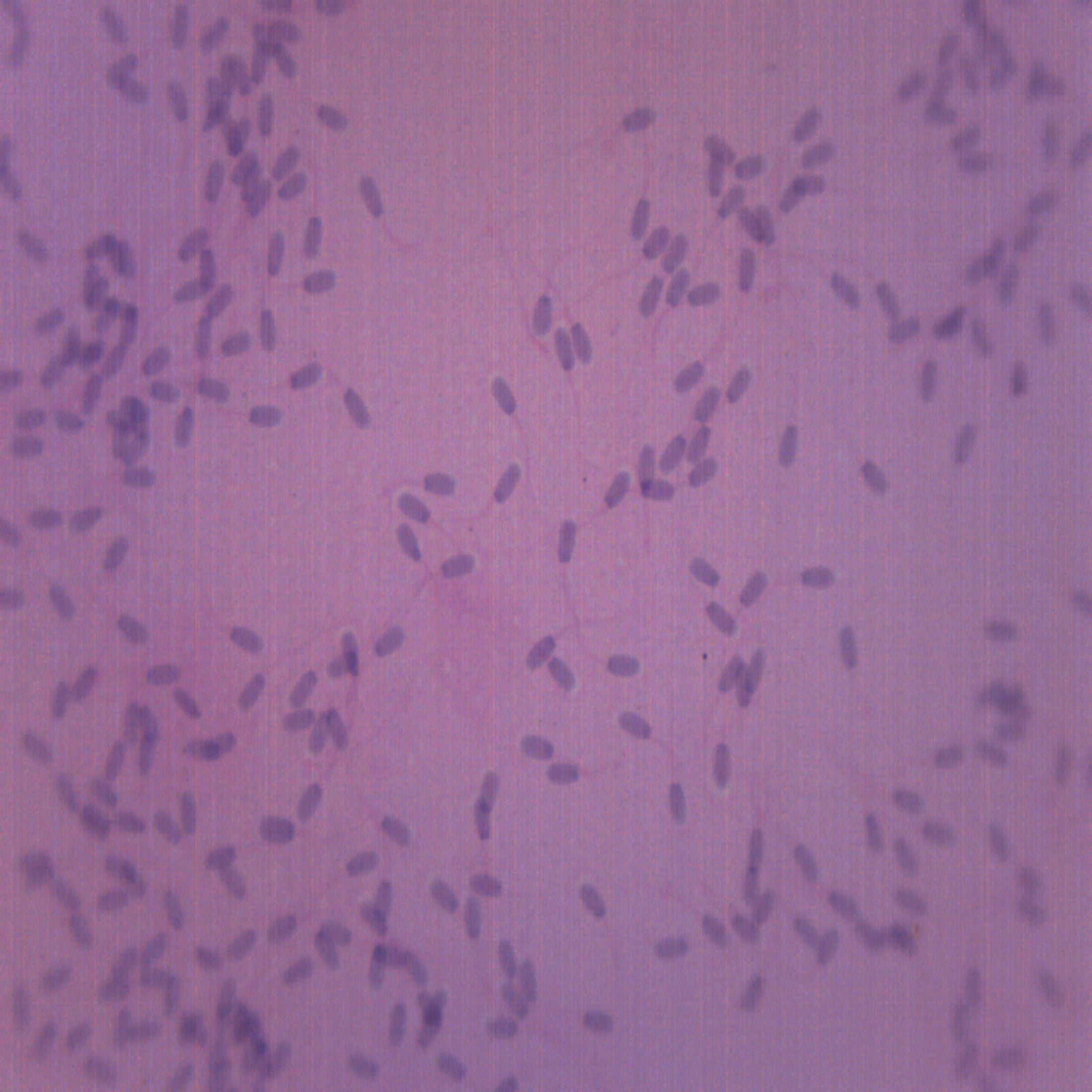 10PK Sperm Smear, Mammal - Prepared Microscope Slides - Classroom Pack ...