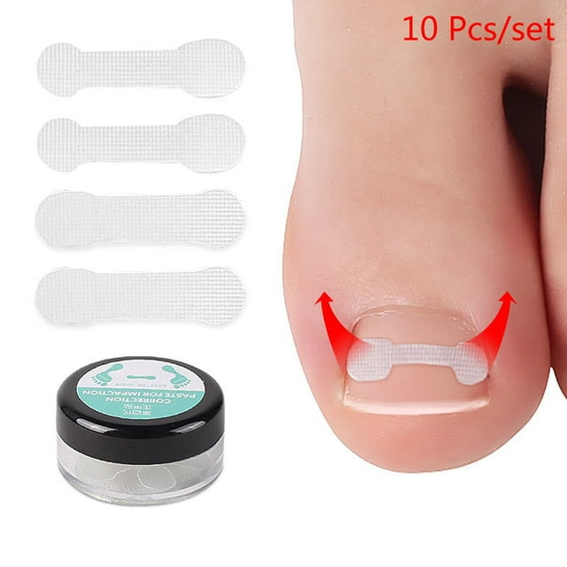 10Pcs Ingrown Toe Nail Correction Sticker Patch Paronychia Corrector ...