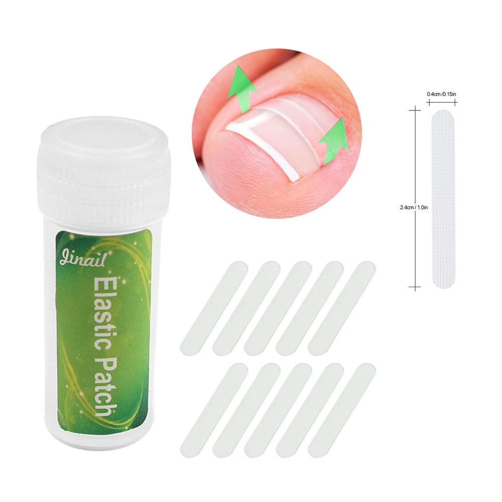 10Pcs Ingrown Toenail Straightening Clip Ingrown Toenail Correction ...