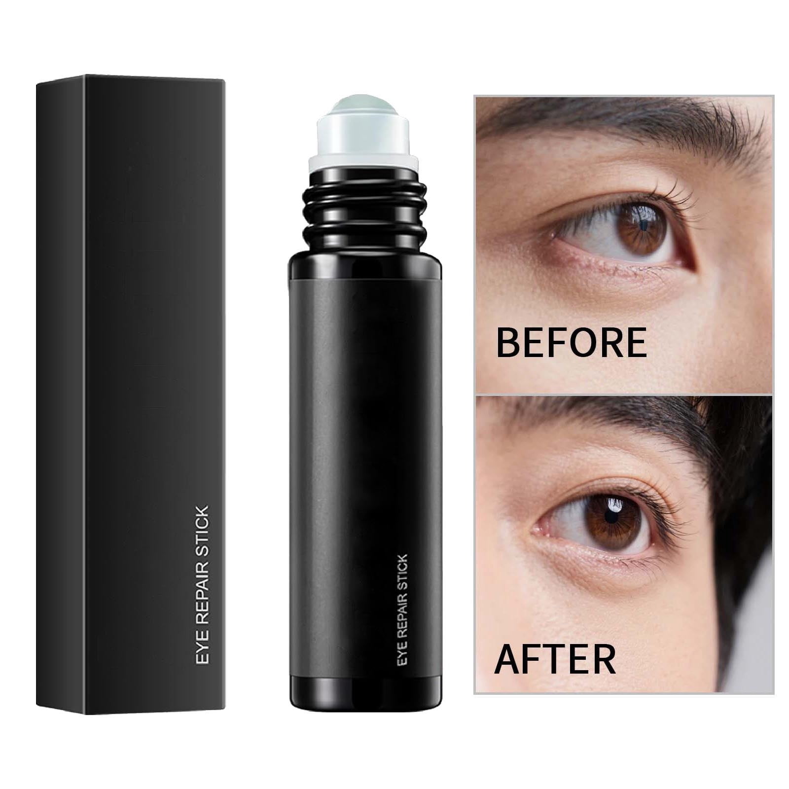 10ml Eye Repair Stick for Men, Reduces Under Eye Dark Circles & Eyebags ...