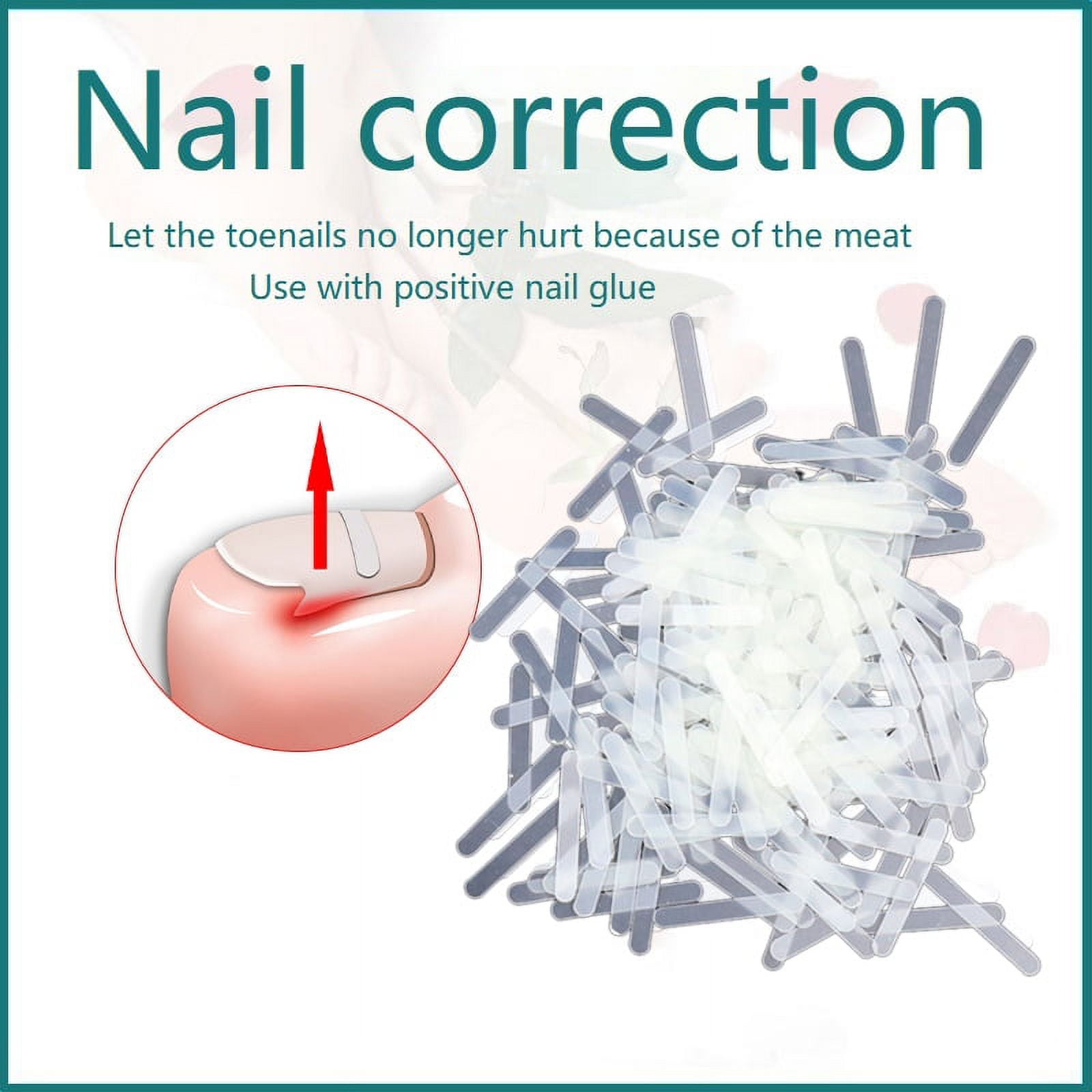 10pcs Ingrown Toenail Correction Tool Toe Nail Treatment Elastic Patch ...