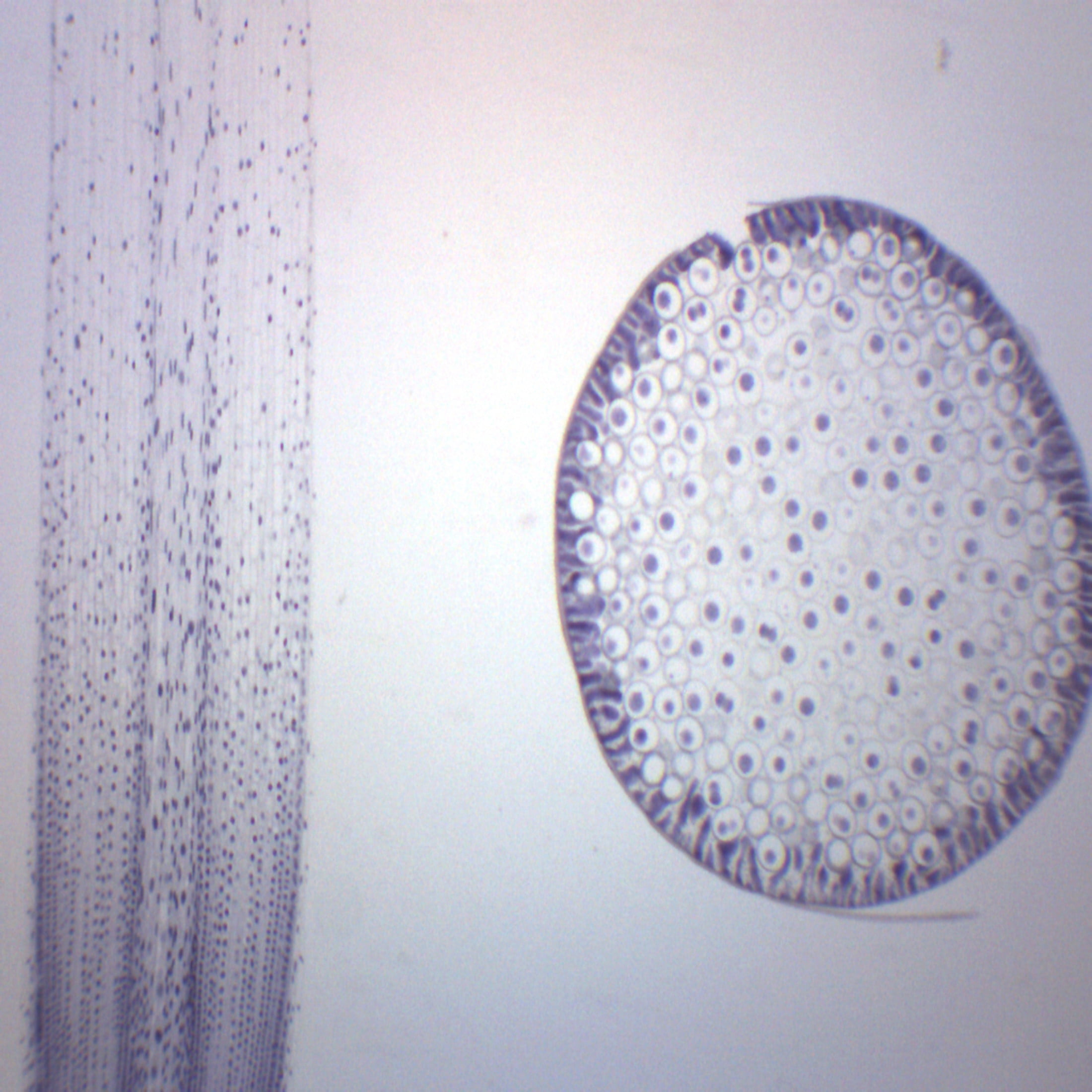 10pk Ascaris & Onion Mitosis, Prepared Microscope Slides - 75 x 25mm ...