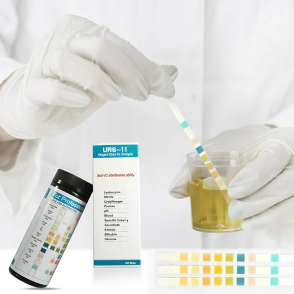 Test Strips Blood Urine