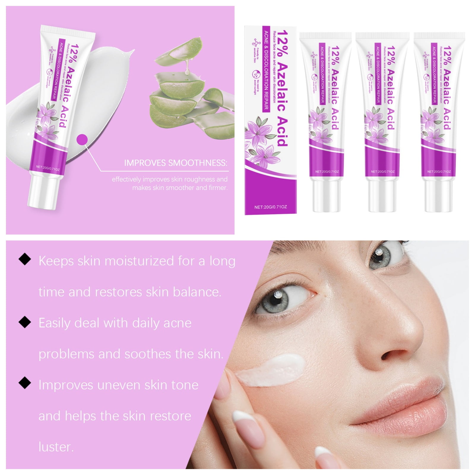 12% A-zelaic Acid Facial Cream – For Oily & Blemish-Prone Skin, Reduces Pimple Visibility ...