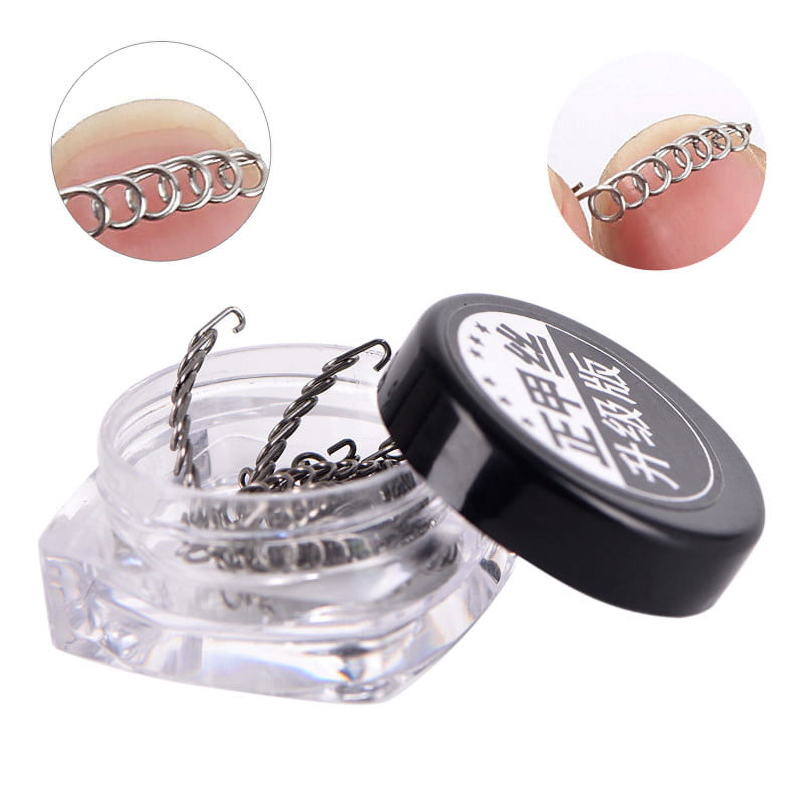 12Pcs Ingrown Toe Nail Correction Wire Fixer Pedicure Paronychia ...