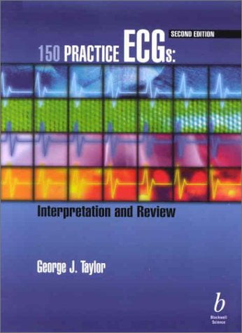 Pre-Owned 150 Practice Ecgs: Interpretation and Review (Spiral-bound ...