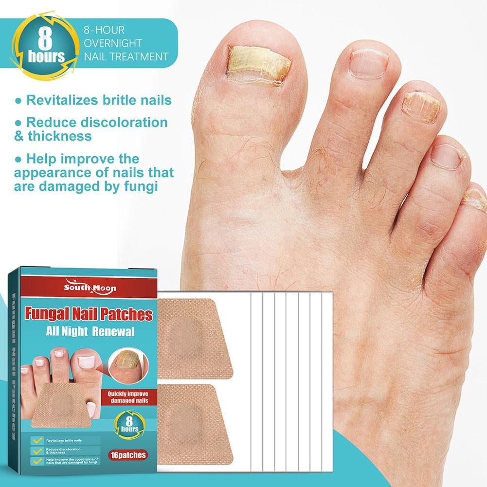 Anti Fungal Nail Treatment Toe Fungus Onychomycosis Repair Sticker, 16/ ...