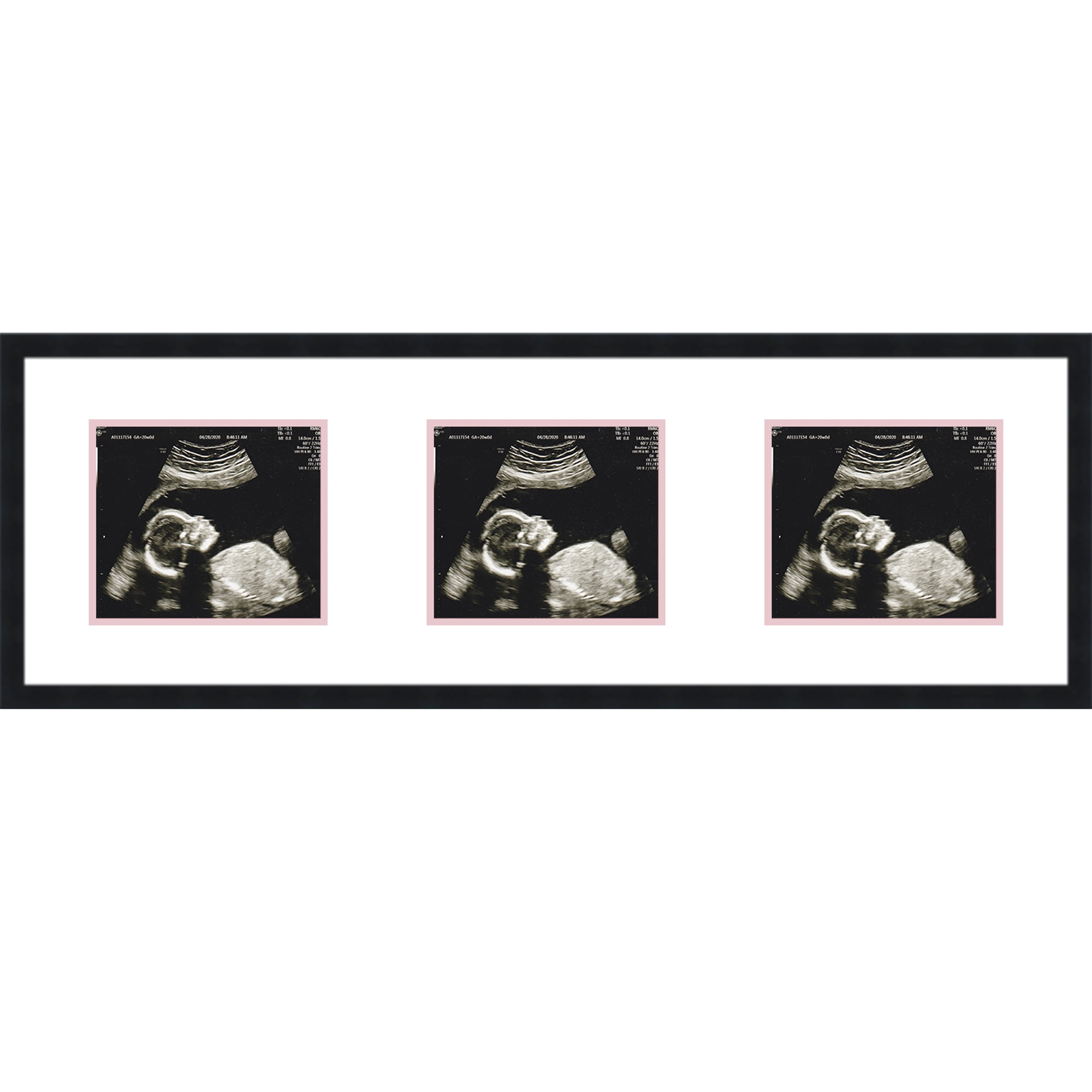 16x5 Black Sonogram Frame with White on Pink Mats with 3 Openings to ...