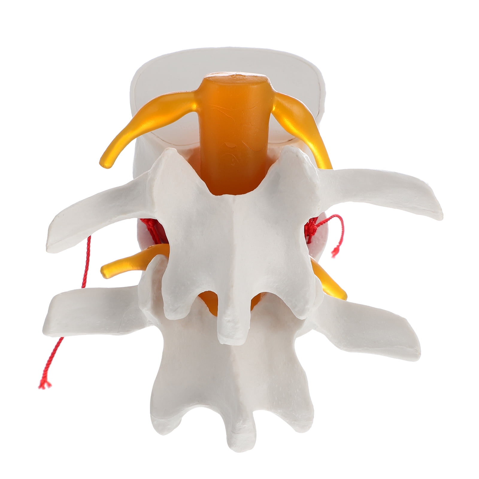 1Pc Human Spine Model Lumbar Disc Herniation Presentation Model for ...
