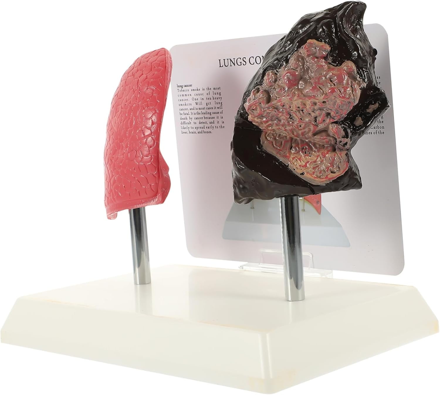 1Pc Respiratory Lung Model Smoking and Lung Comparison for Medical ...