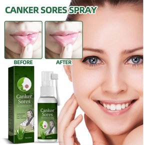 Canker Sore Treatment