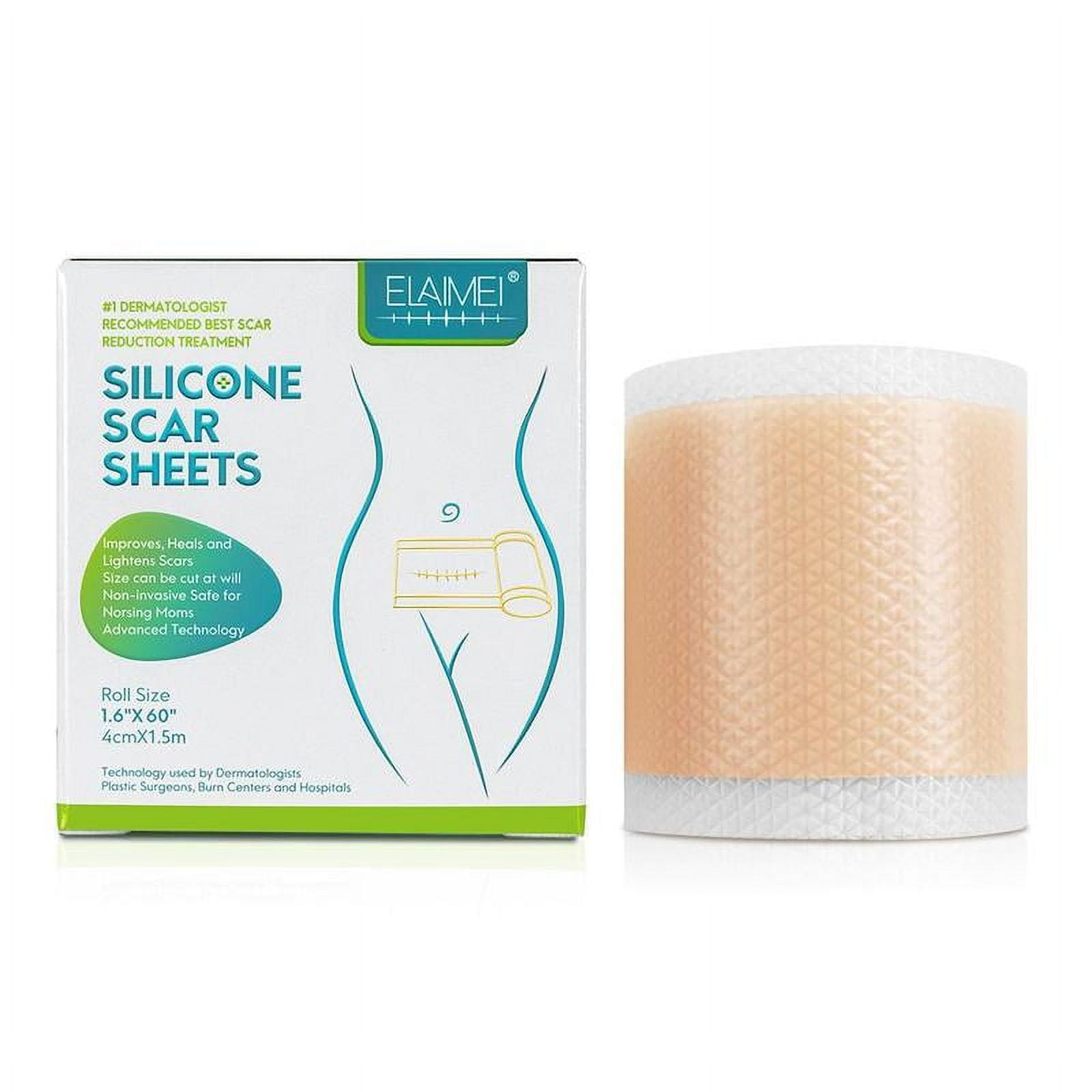 1roll Silicone Gel Scar Stickers Plaster Adhesive Scars Removal ...