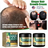 SheaMoisture 2% Minoxidil Topical Solution UPS Women's Hair Regrowth ...