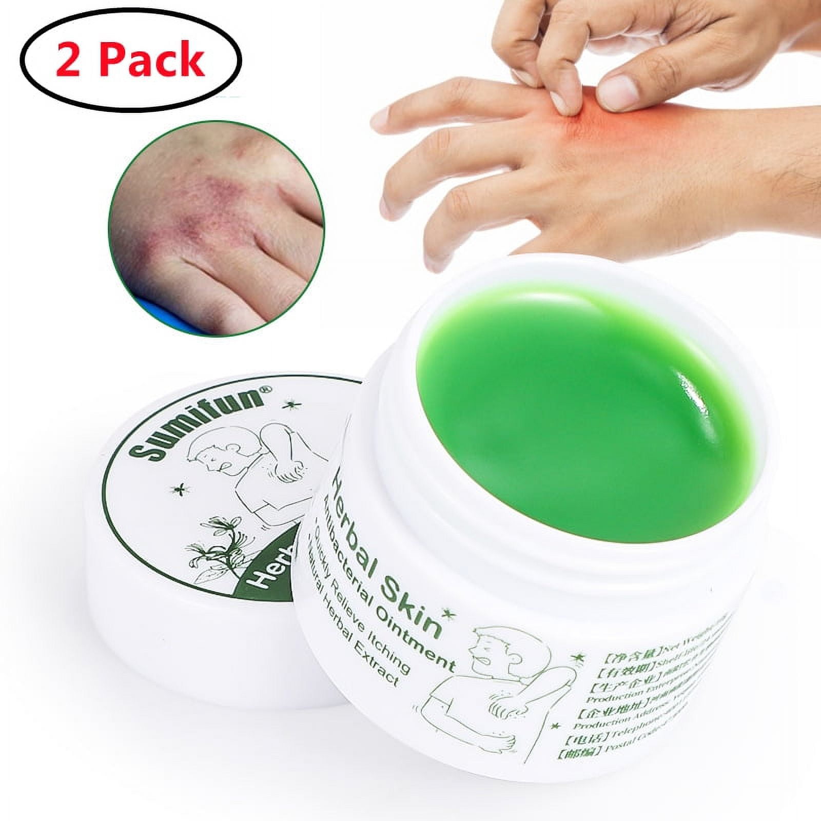 2 Pack Bug Bite Cream, Natural Insect Bite Pain & Itch Relief - Walmart.com